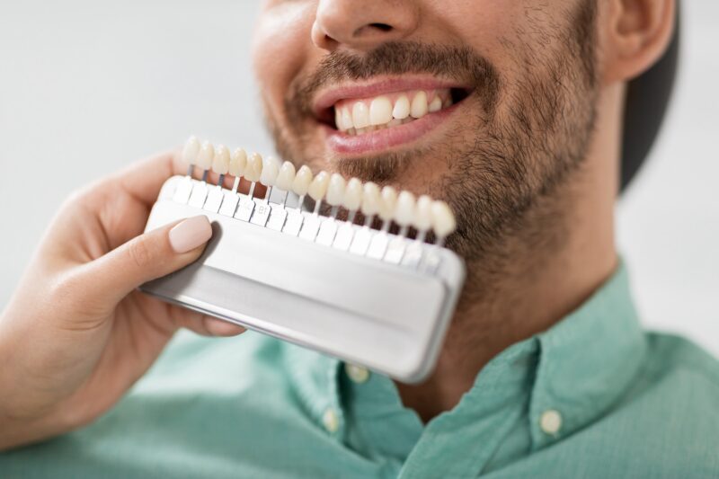 Everything You Need to Know About Dental Veneers - Frederick MD ...